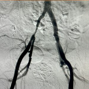 CAZ nr 73: Boala Ebstein - Ghid radiologie
